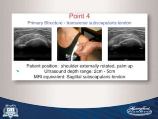 Anatomy and physical exam of the shoulder | PPTX