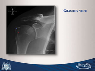 Anatomy and physical exam of the shoulder | PPTX