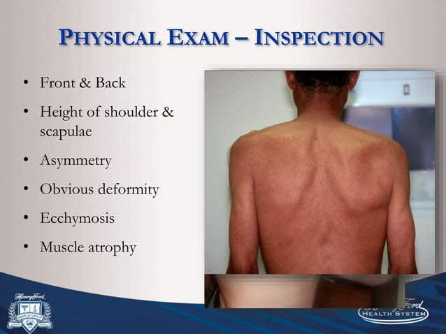 Anatomy and physical exam of the shoulder | PPTX | Death, Injury, or ...