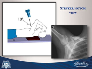 Anatomy and physical exam of the shoulder | PPT