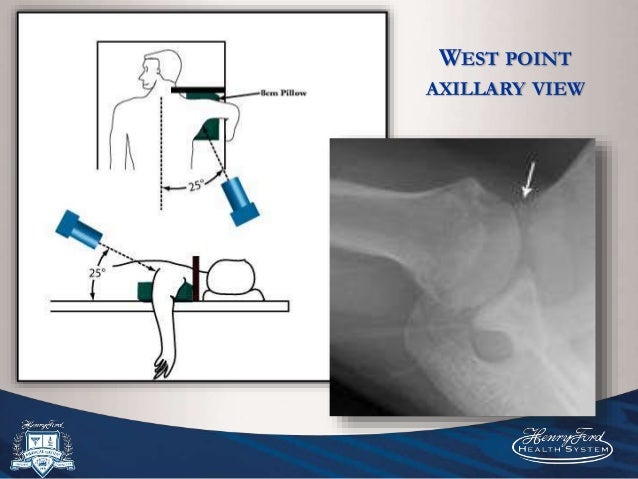 Anatomy and physical exam of the shoulder