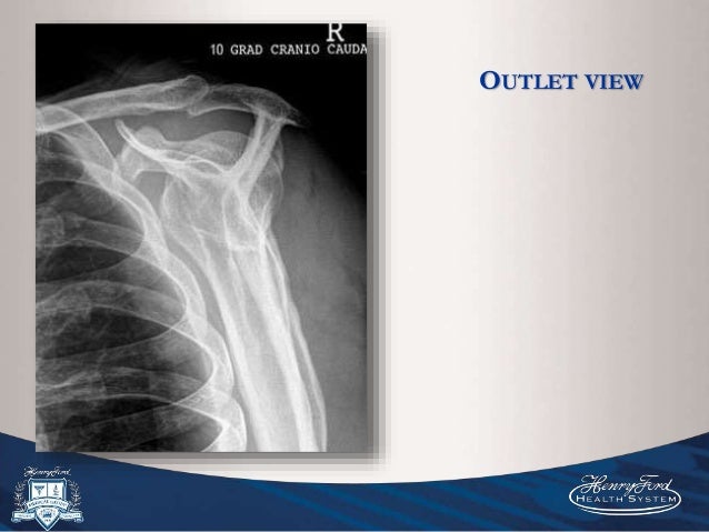 Outlet View Shoulder | Paul Smith