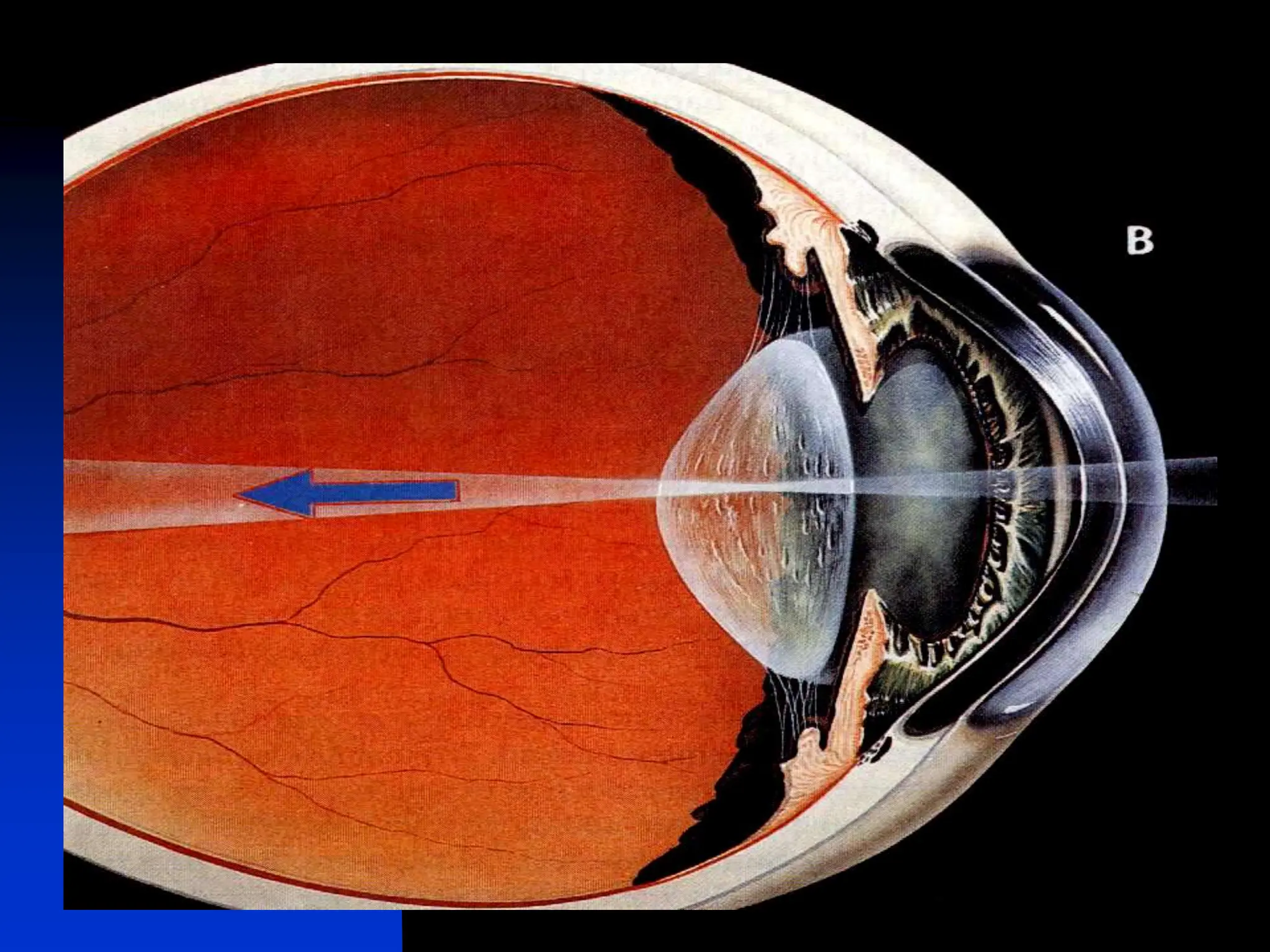 Anatomy and Physiology.ppt of eye uploaded | PPT