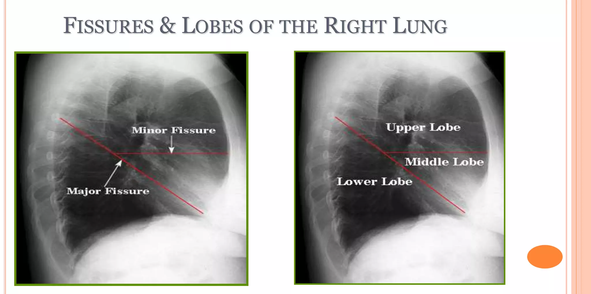 Anatomy and physiology of lung | PPTX
