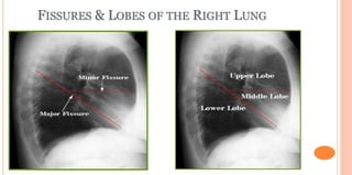 Anatomy and physiology of lung | PPTX