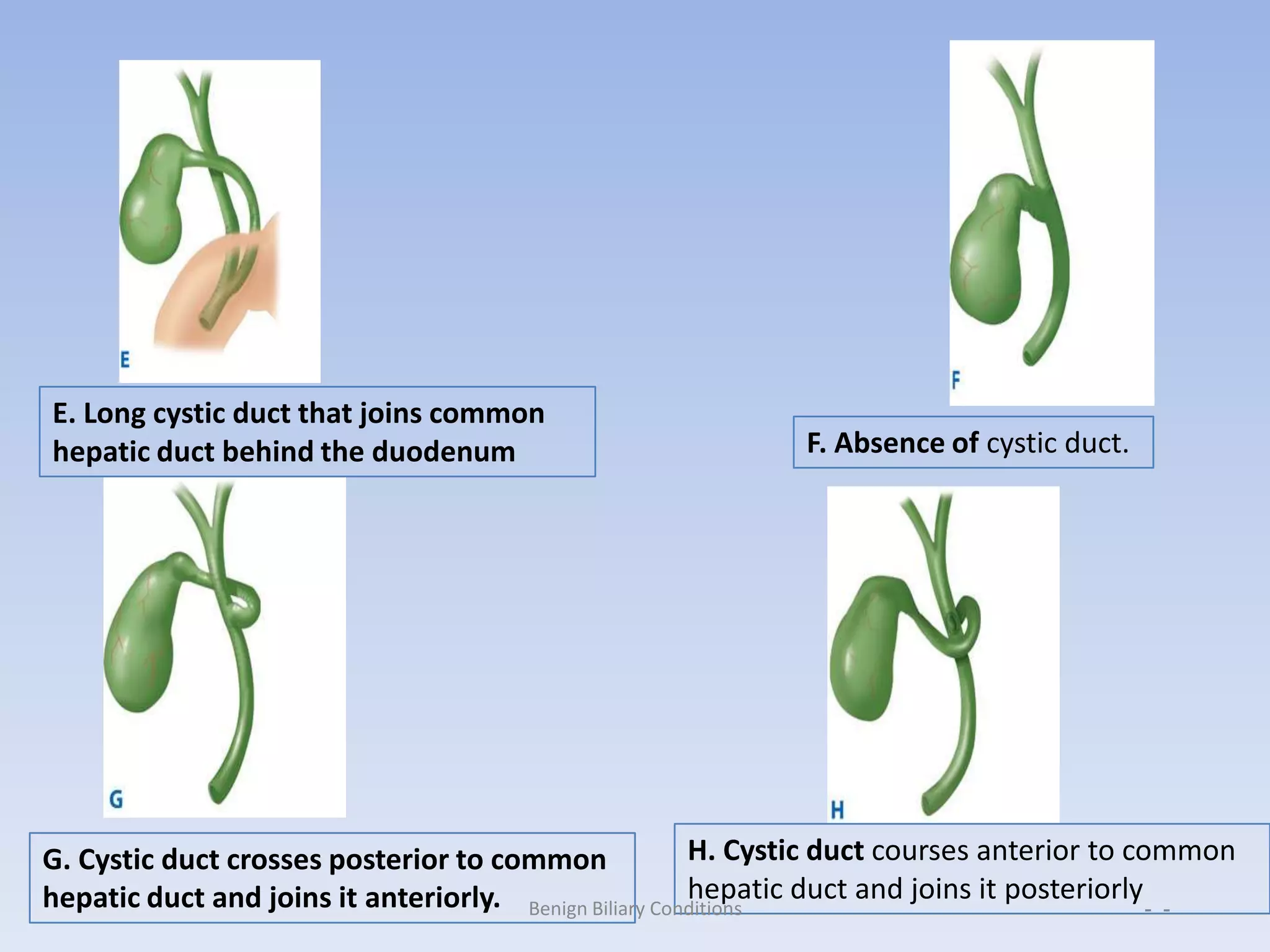 Anatomy and physiology of biliary tree | PPTX