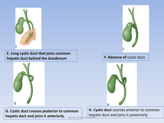 Anatomy and physiology of biliary tree