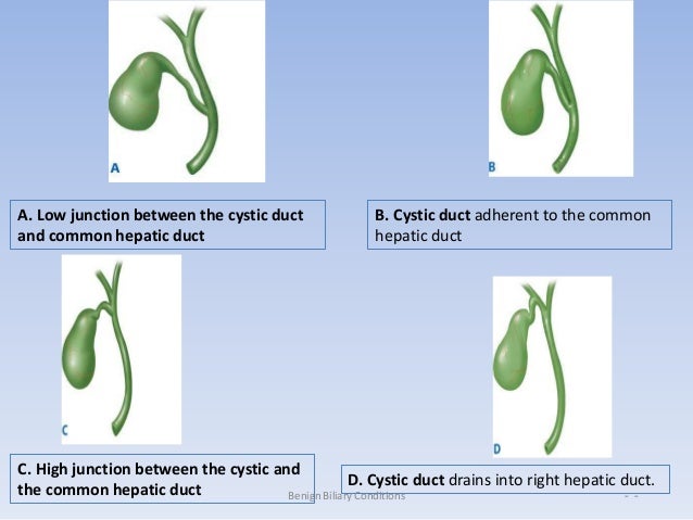 Anatomy and physiology of biliary tree