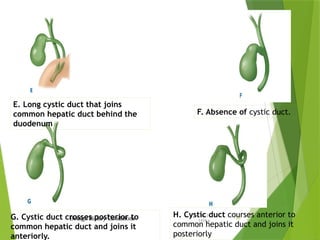 anatomy and physiologyofbiliarytree.pptx