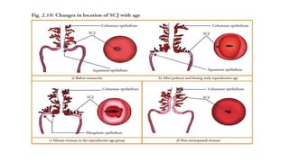 Anatomy and Physiology of cervix.pptx