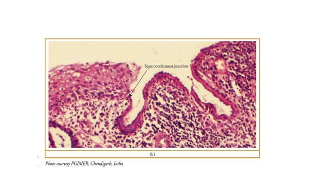 Anatomy And Physiology Of Cervix Pptx