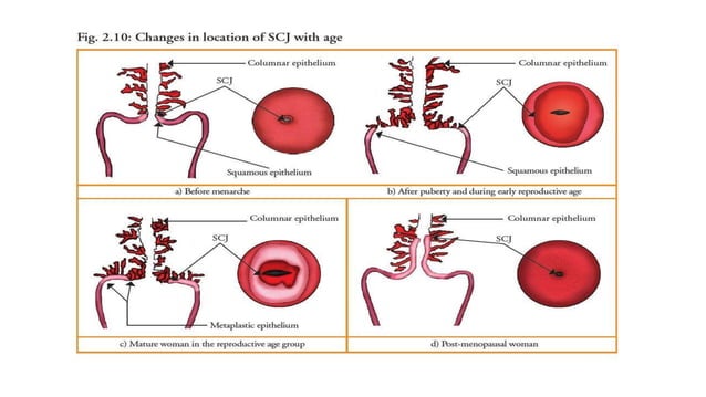 Anatomy And Physiology Of Cervix Pptx