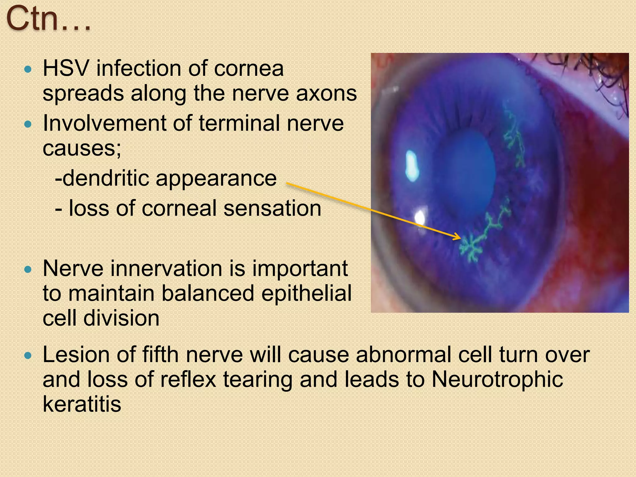 Anatomy and physiology of cornea | PPTX