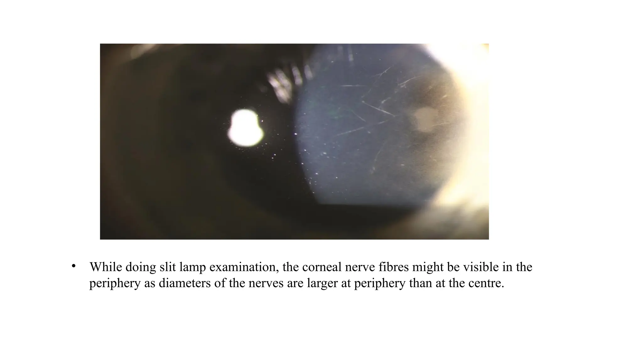 Anatomy and Physiology of Cornea powerpoint.pptx