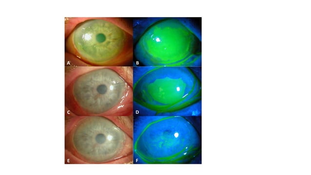 Anatomy and Physiology of Cornea powerpoint.pptx