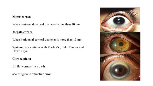 Anatomy and Physiology of Cornea powerpoint.pptx