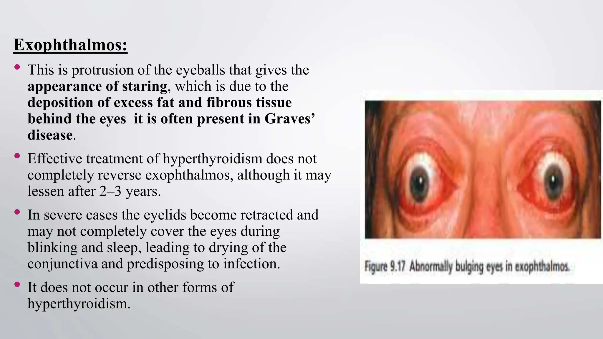 ANATOMY AND PHYSIOLOGY OF ENDOCRINE SYSTEM.pptx