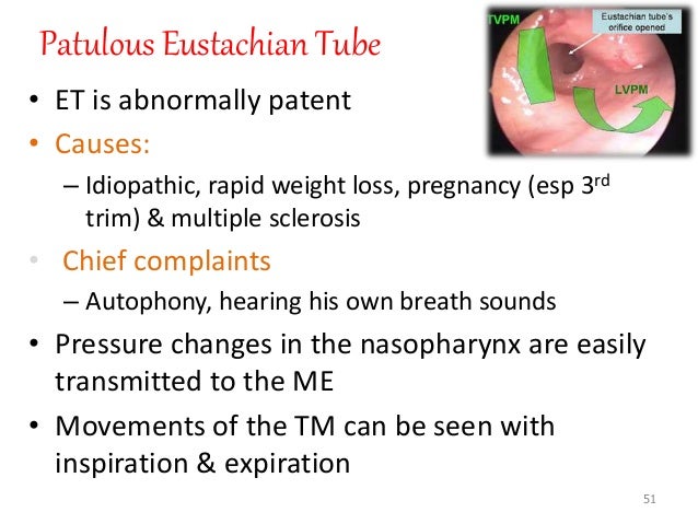 Anatomy and physiology of eustachian tube