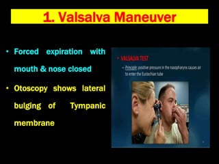 Anatomy and physiology of Eustachian tube .ppt