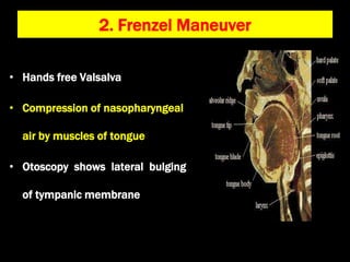 Anatomy and physiology of Eustachian tube .ppt
