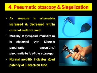 Anatomy and physiology of Eustachian tube .ppt