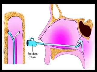 Anatomy and physiology of Eustachian tube .ppt