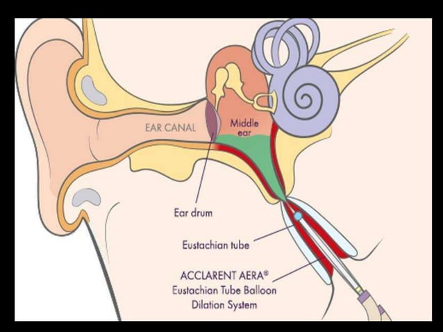 Anatomy and physiology of Eustachian tube .ppt