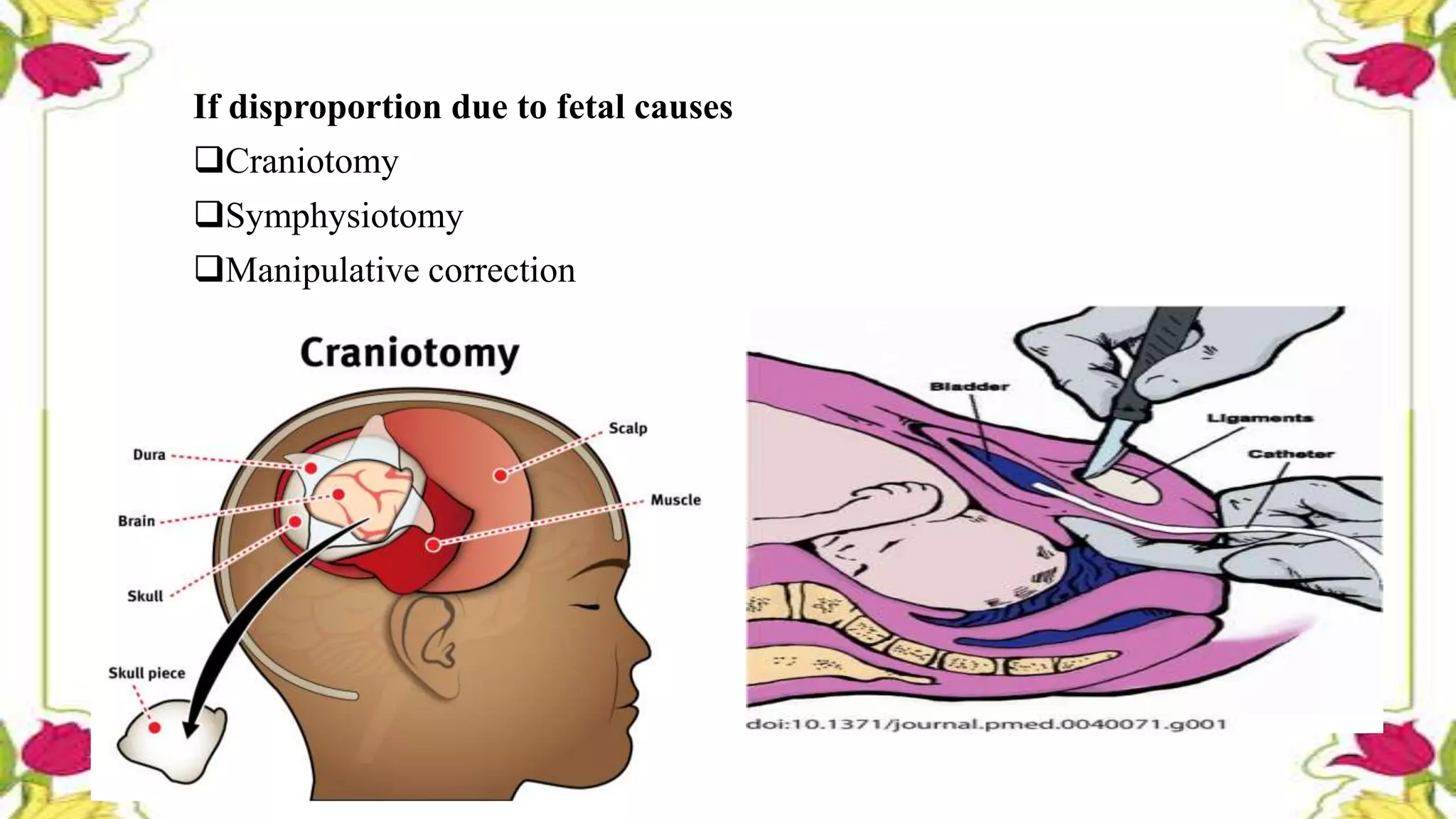 ANATOMY AND PHYSIOLOGY OF FEMALE REPRODUCTIVE SYSTEM.pptx