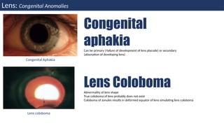 Anatomy and physiology of Lens. power point | PPTX