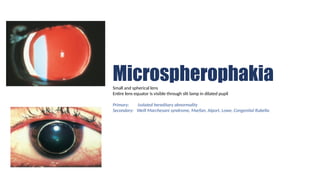 Anatomy and physiology of Lens. power point | PPTX