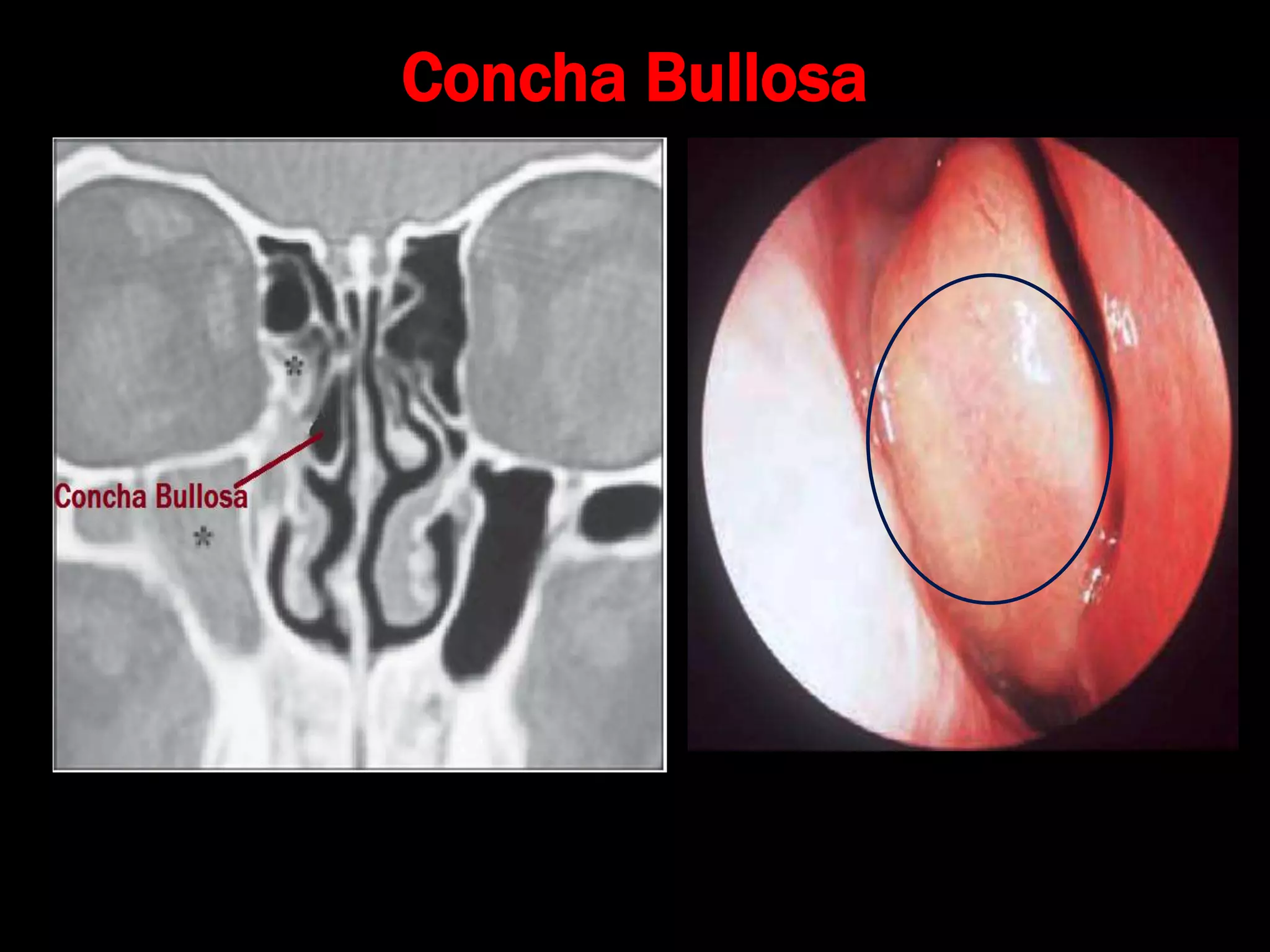 Anatomy and physiology of nose and paranasal sinuses | PPT