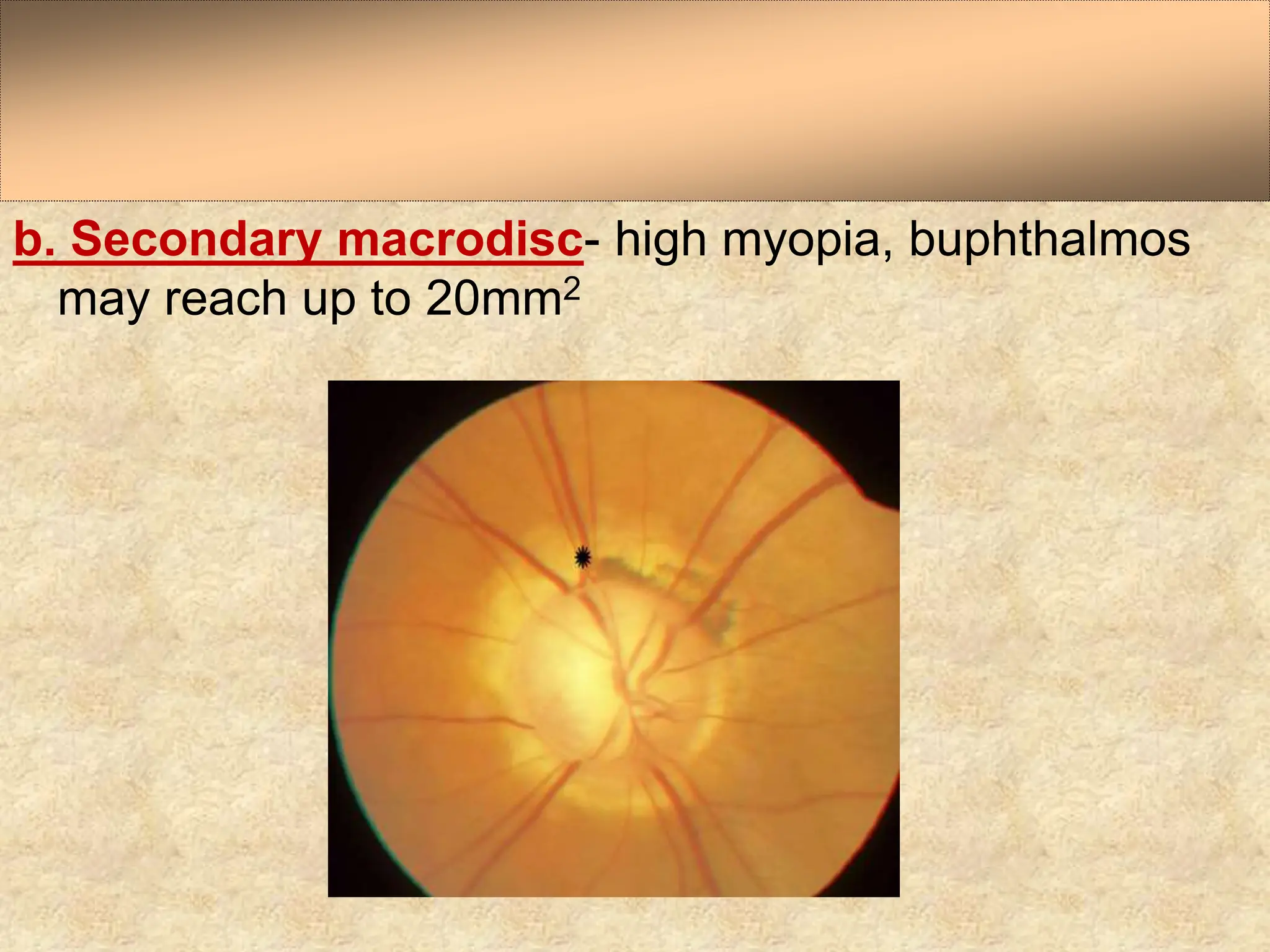 Anatomy and Physiology of Optic Nerve Dr.PrabhatDevkota.pptx