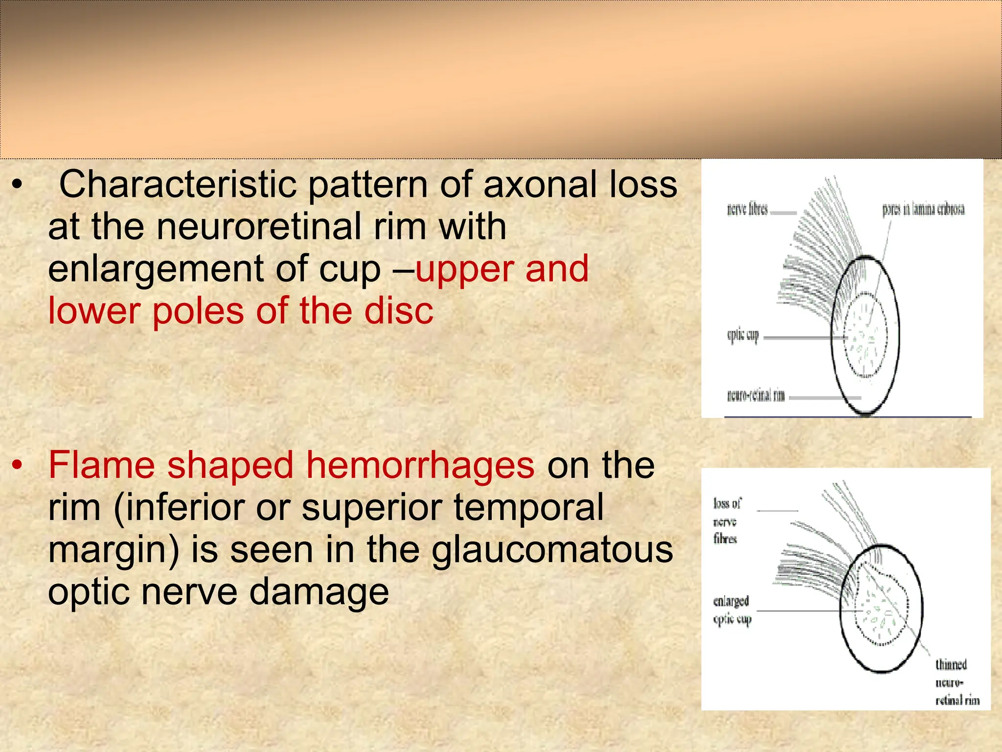 Anatomy and Physiology of Optic Nerve Dr.PrabhatDevkota.pptx