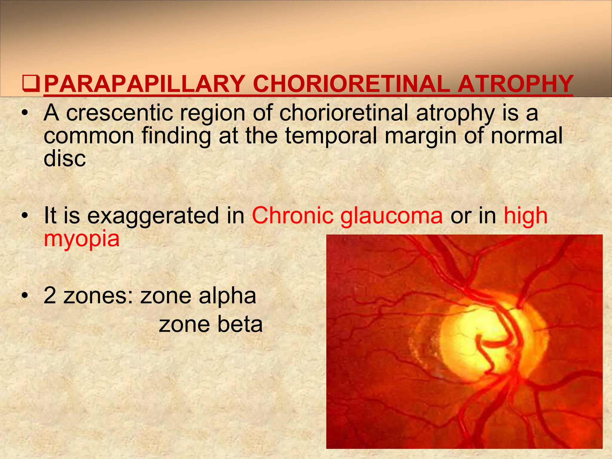 Anatomy and Physiology of Optic Nerve Dr.PrabhatDevkota.pptx