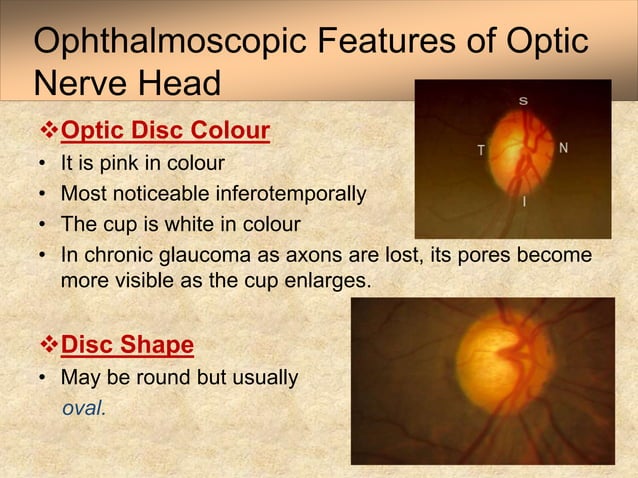 Anatomy and Physiology of Optic Nerve Dr.PrabhatDevkota.pptx | Eye and ...
