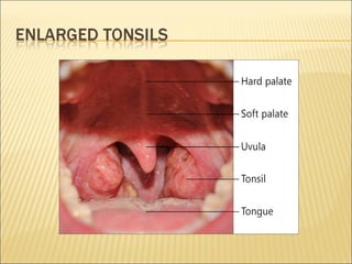 Anatomy and physiology of oral cavity oropharynx waldeyer’s | PPT