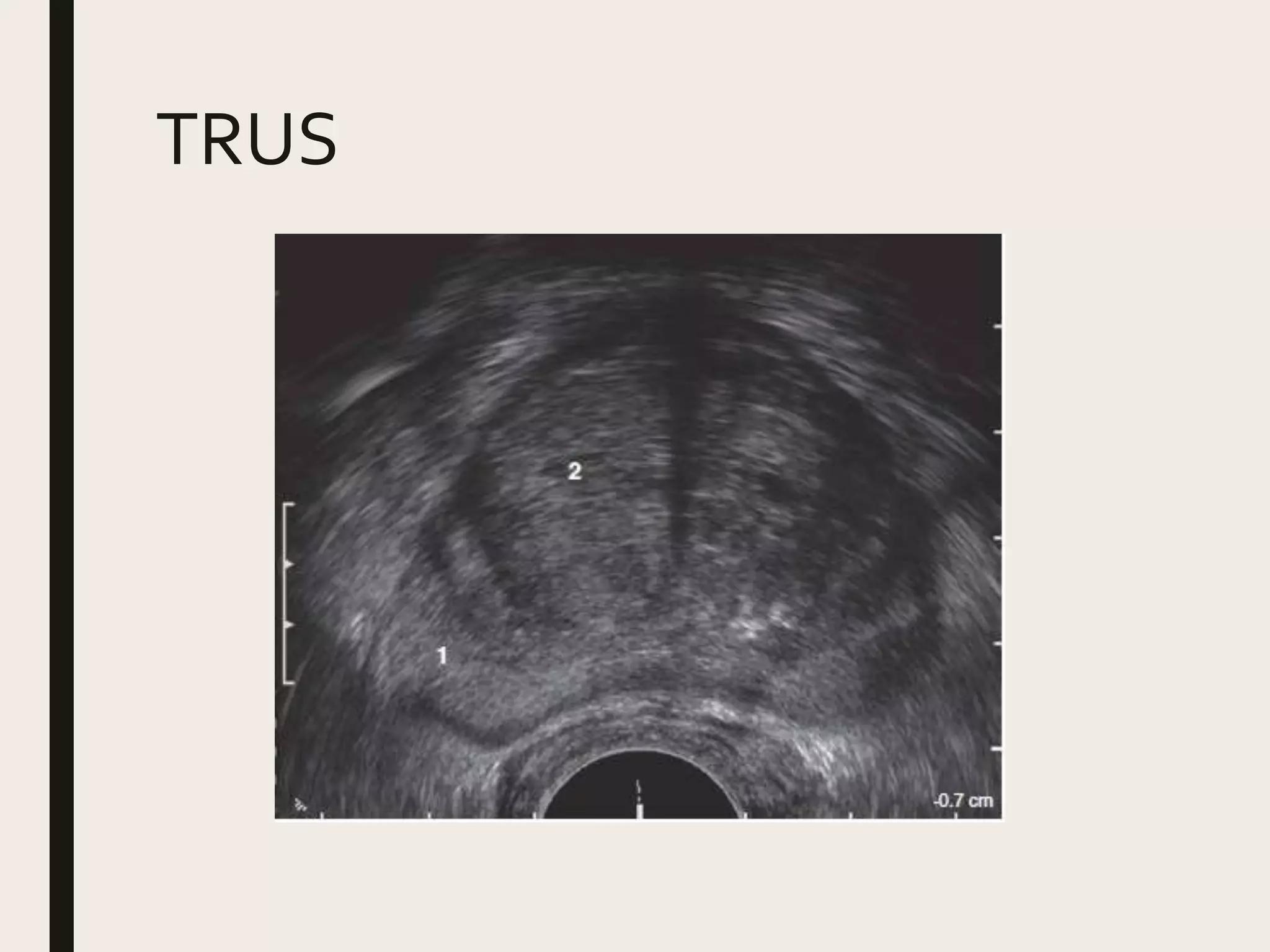 Anatomy and physiology of prostate | PPTX