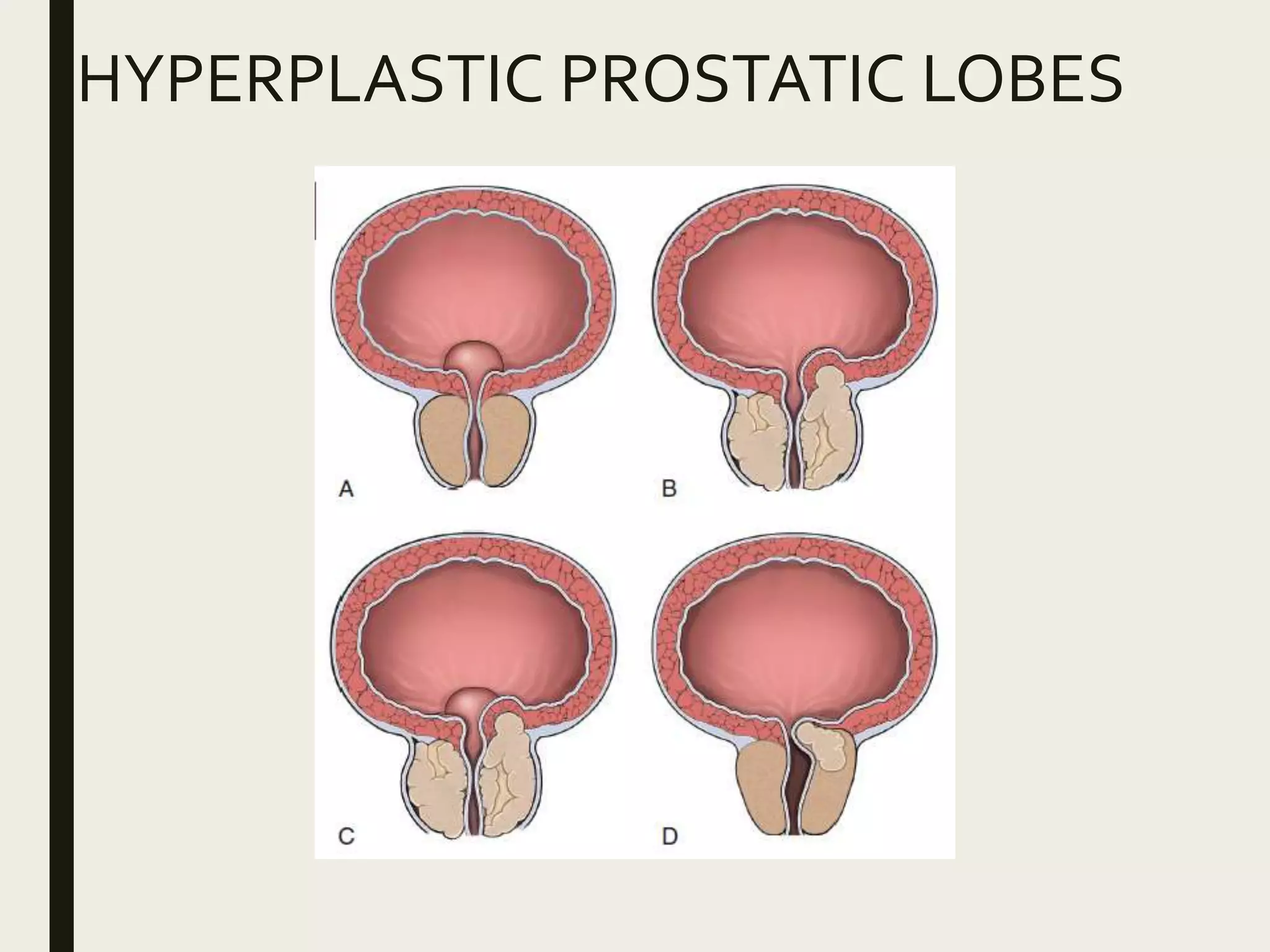 Anatomy and physiology of prostate | PPTX