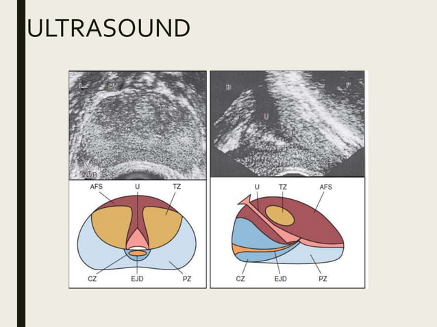 Anatomy and physiology of prostate | PPTX