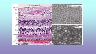 ANATOMY AND PHYSIOLOGY OF RETINA ( Part 2)[1].pptx