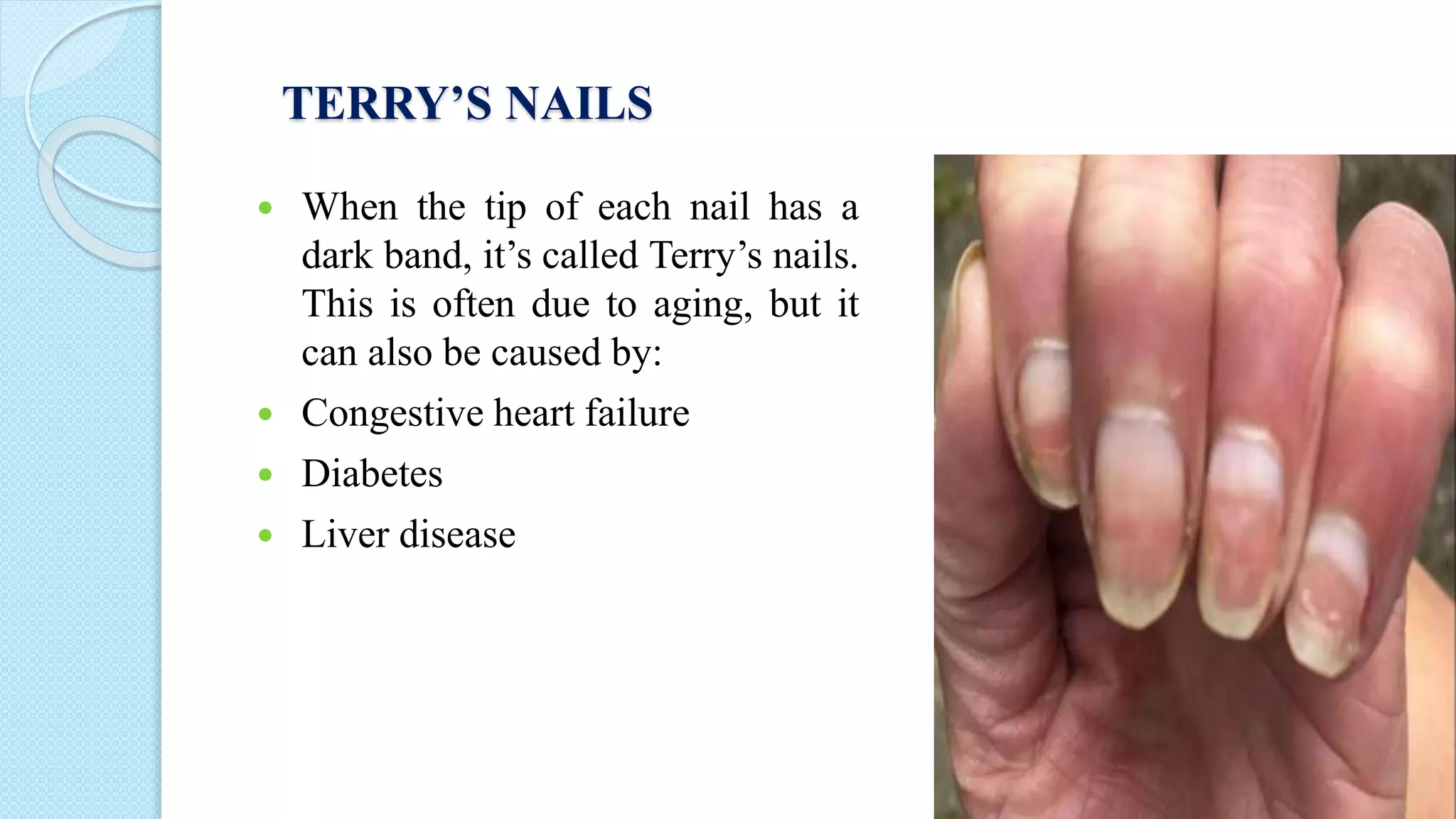 Anatomy and physiologyof skin | PPTX