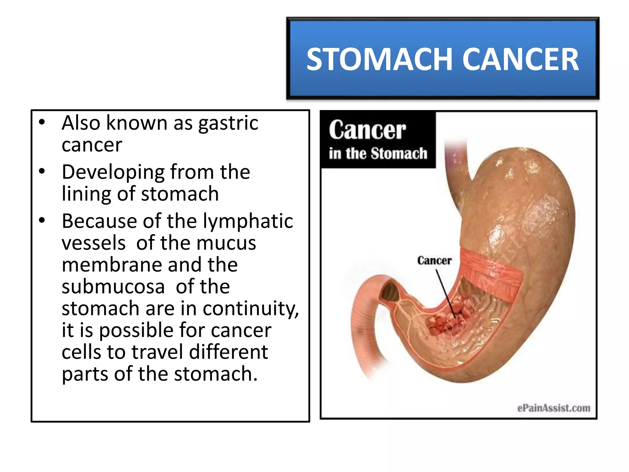Anatomy and physiology of stomach and its interpretations | PPTX