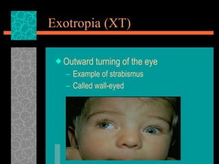Anatomy and physiology of the eye