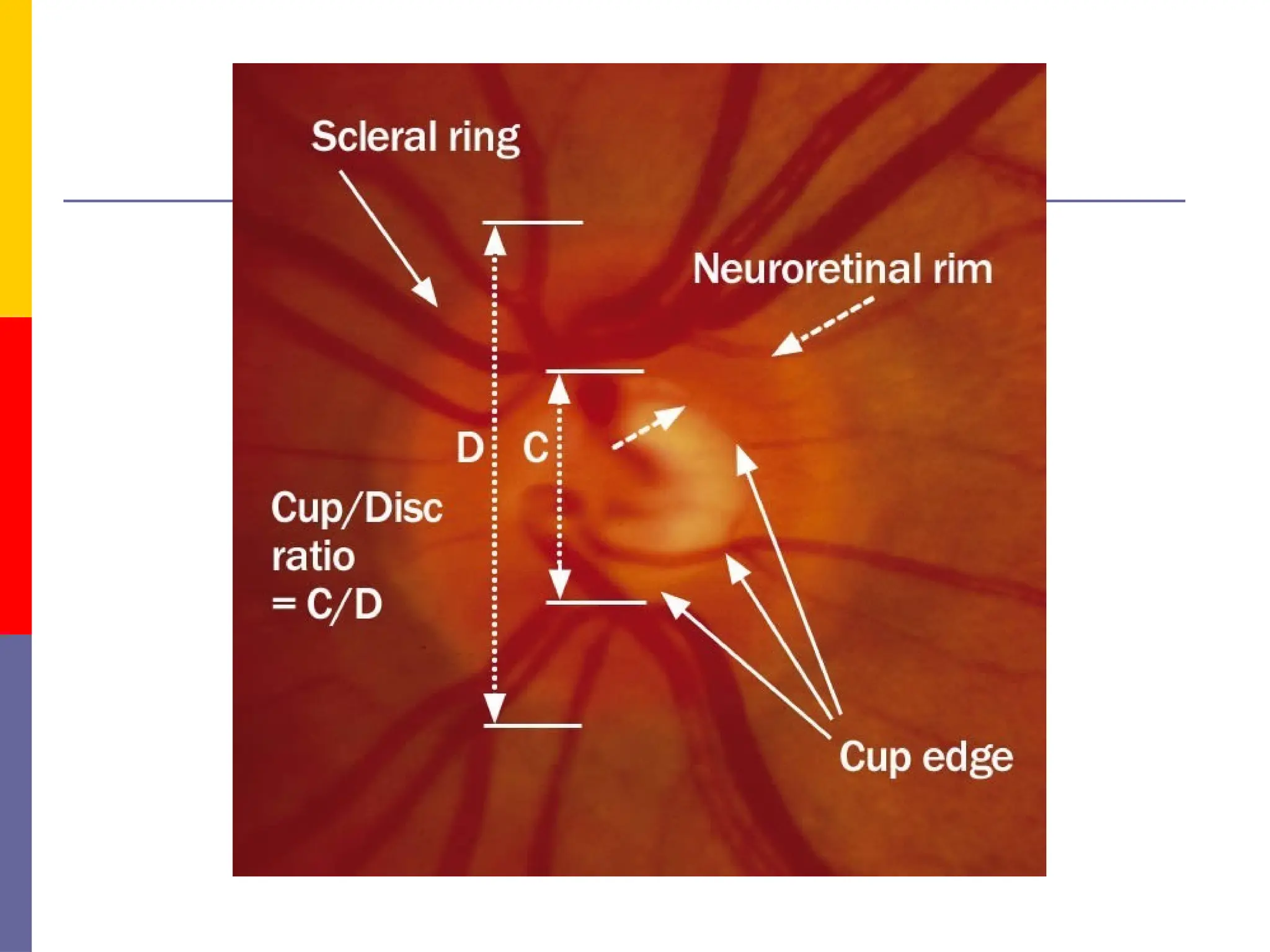 Anatomy and physiology of the eye by Dr Iqra.pptx