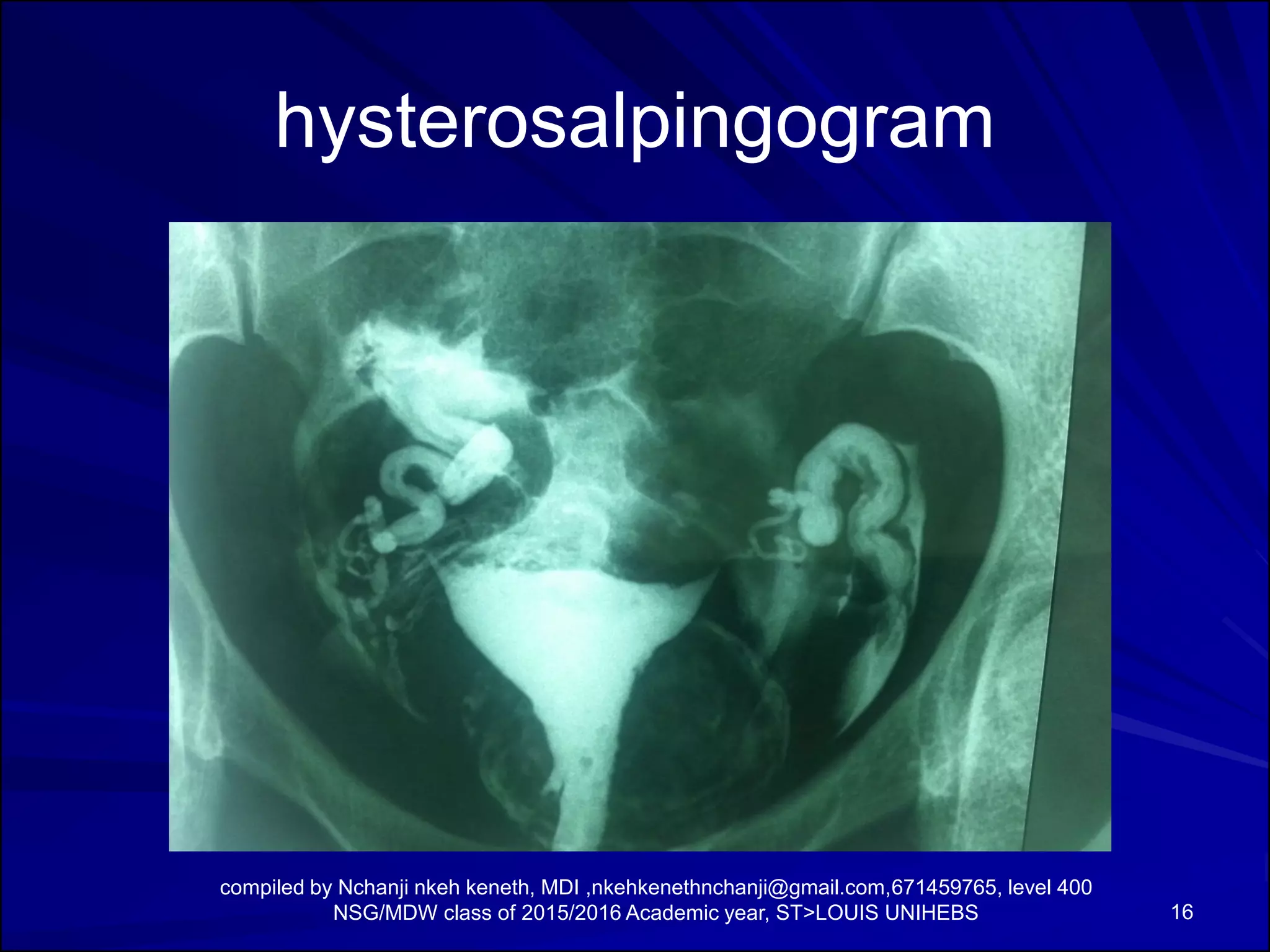 Anatomy And Physiology Of The Female Pelvic Organs Ppt