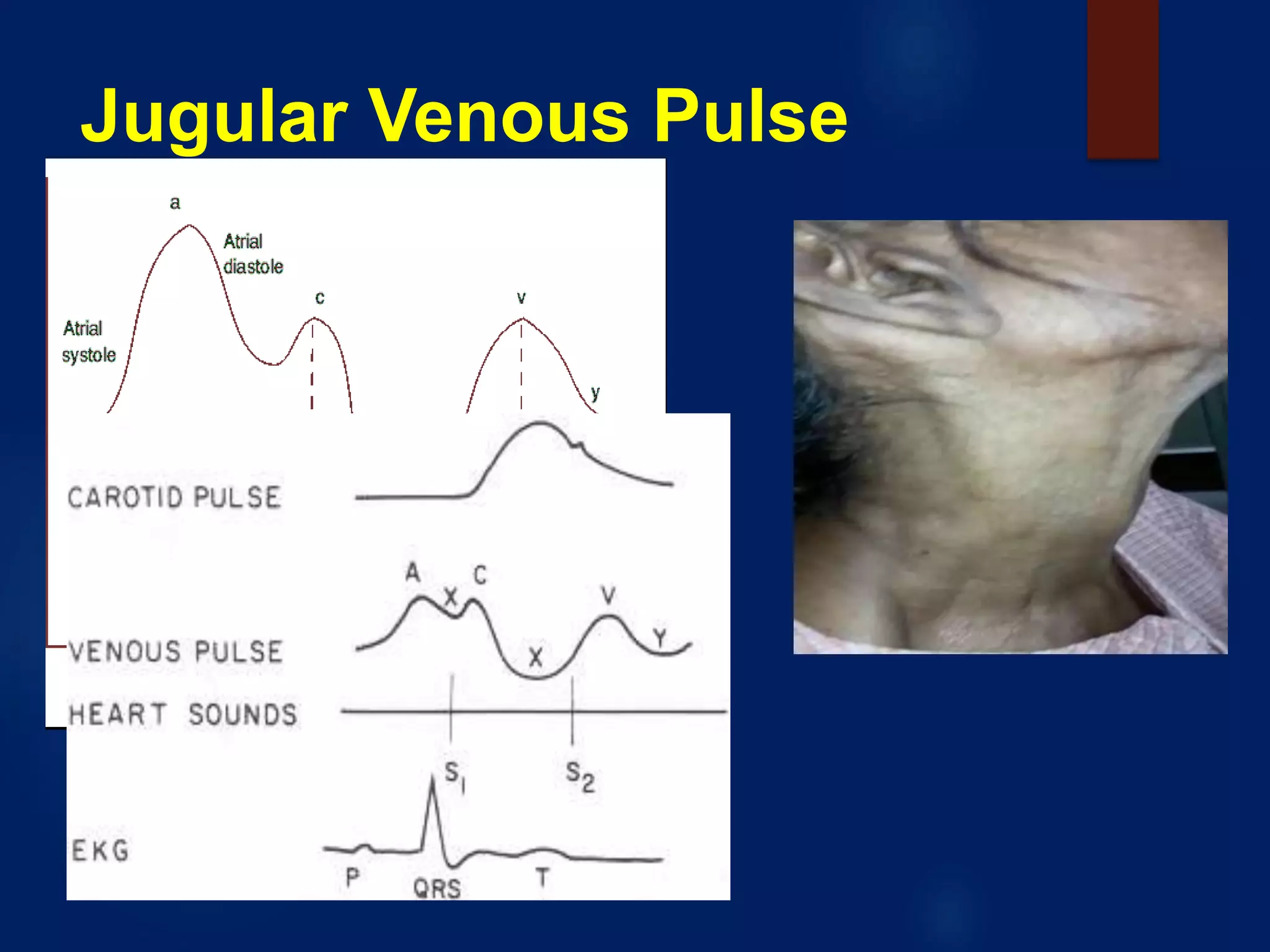 ANATOMY AND PHYSIOLOGY OF THE HEART | PPTX