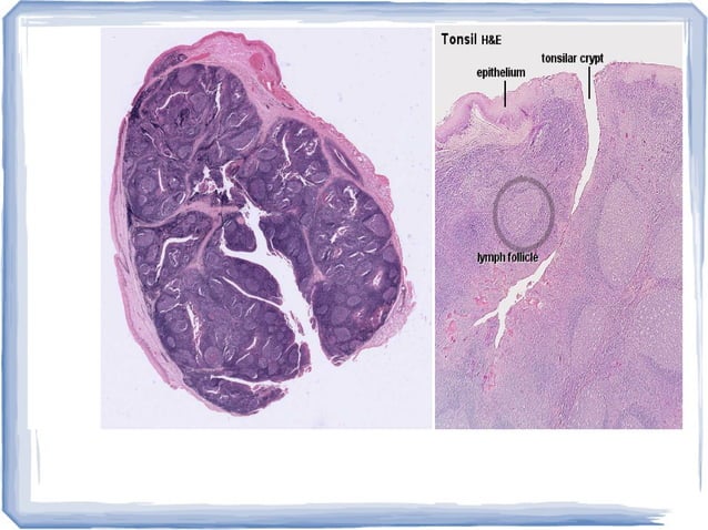 Anatomy and physiology of the palatine tonsil | PPT | Ear, Nose and ...