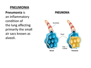 Anatomy and physiology of the respiratory system | PPTX