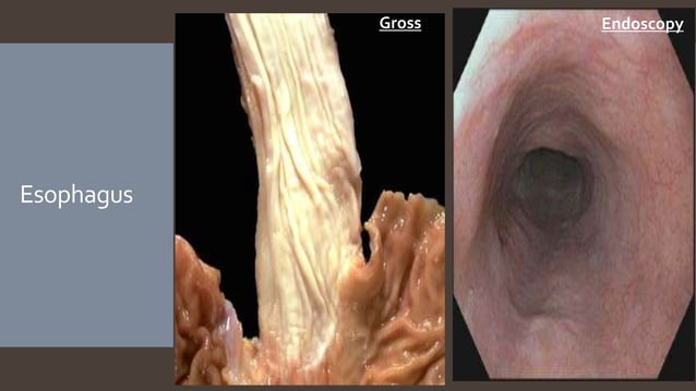 Anatomy and physiology of upper gi tract | PPTX | Digestive Disorders ...