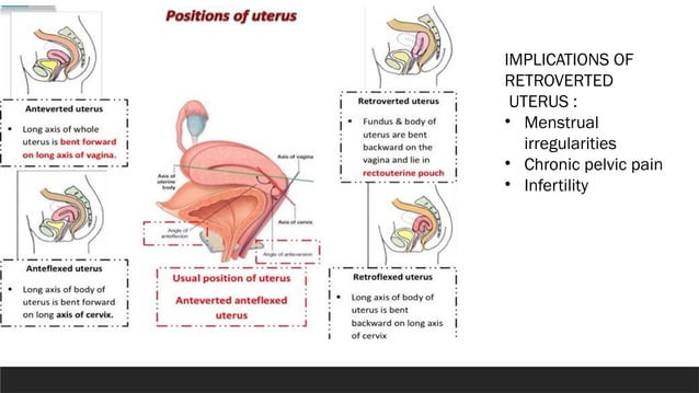 Anatomy of Uterus and physiology of Uterus | PPTX